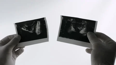 Male Prostate Stock Footage ~ Royalty Free Stock Videos | Pond5