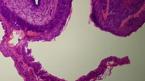 Biopsy Stock Videos – Royalty-Free HD & 4K Videos | Page 2