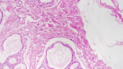 Mammary gland secretion stage magnified ... | Stock Video | Pond5