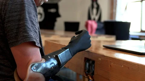 Man with amputated two stump hands looks... | Stock Video | Pond5
