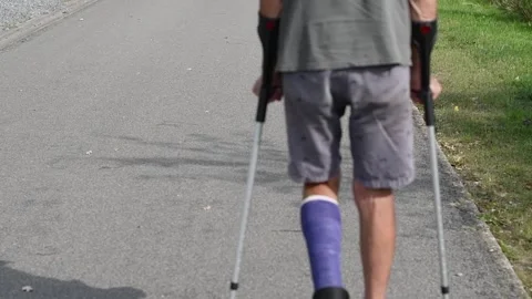 Broken Leg Cast Stock Videos – Royalty-Free HD & 4K Videos