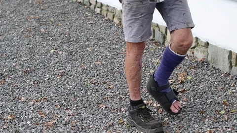 man with broken left leg in modern blue ... | Stock Video | Pond5