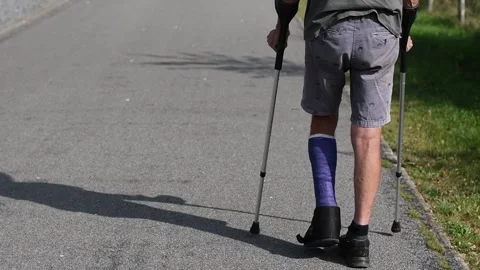man with broken left leg in modern blue ... | Stock Video | Pond5