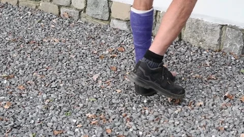 man with broken left leg in modern blue ... | Stock Video | Pond5