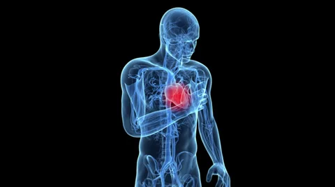 Heart Attack Stock Footage ~ Royalty Free Stock Videos | Pond5