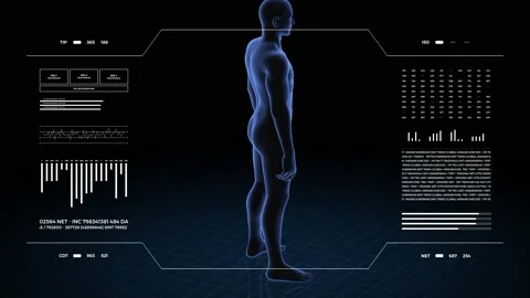 Man with pathology. 3d body of boy. Male... | Stock Video | Pond5