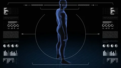 Man with pathology. 3d body of boy. Male... | Stock Video | Pond5