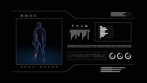 Man with pathology. 3d body of boy. Male... | Stock Video | Pond5