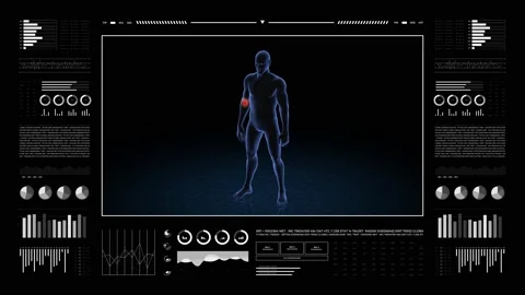 Man with pathology. 3d body of boy. Male... | Stock Video | Pond5