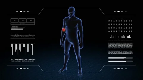 Man with pathology. 3d body of boy. Male... | Stock Video | Pond5