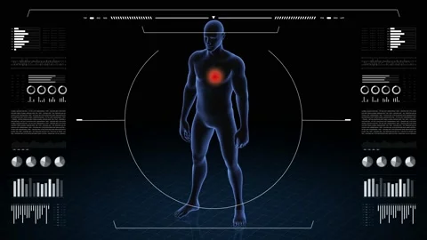 Man with pathology. 3d body of boy. Male... | Stock Video | Pond5