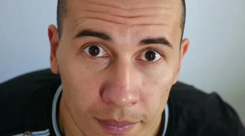 man person problem skin, acne and face s... | Stock Video | Pond5