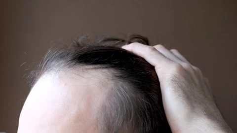 Man running his hand through his hair on... | Stock Video | Pond5