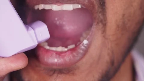 Managing asthma with inhaler use in dail... | Stock Video | Pond5