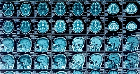 Many MRI scans of various sizes, looped | Stock Video | Pond5