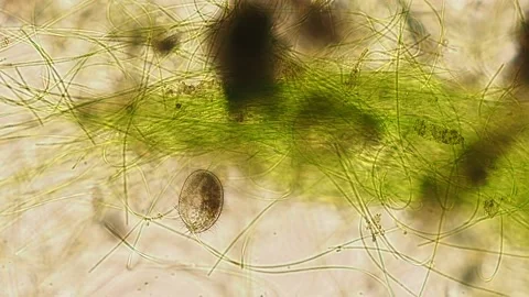 marine ciliate (single celled organism) ... | Stock Video | Pond5