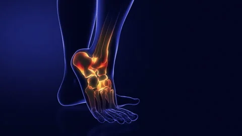 Medical animation for ankle pain | Stock Video | Pond5