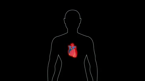 Medical animation of heart disease. Huma... | Stock Video | Pond5