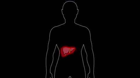 Medical animation of liver disease. Huma... | Stock Video | Pond5