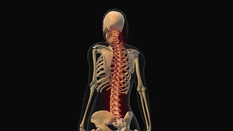 Medical animation of the spine bone pain | Stock Video | Pond5