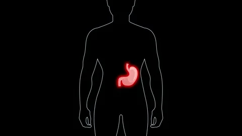 Medical animation of stomach disease. Hu... | Stock Video | Pond5