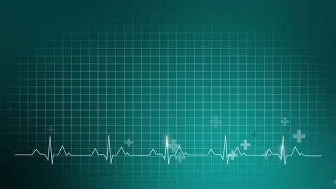 Screensaver Stock Video Footage | Royalty Free Screensaver Videos | Pond5