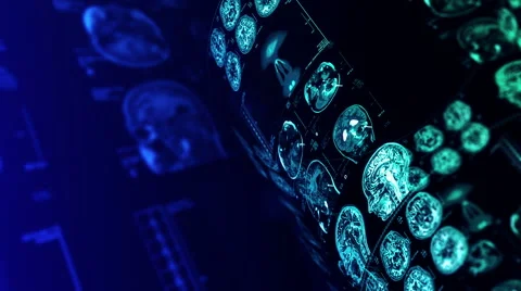 Medical Background Stock Video Footage | Royalty Free Medical ...