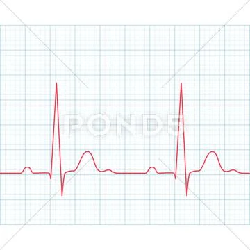 Medical electrocardiogram - ECG on grid: Graphic #56579085