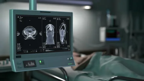 Medical imaging diagnostic device scanni... | Stock Video | Pond5
