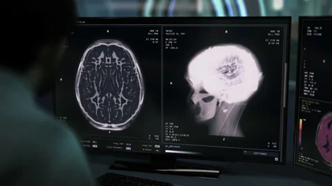 Medical injury treatment analysis system... | Stock Video | Pond5