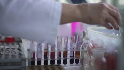Medical lab researcher at work, sorting ... | Stock Video | Pond5