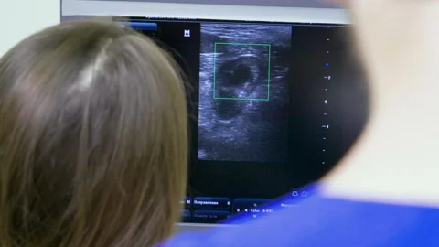 Medical scan. Chihuahua dog is on ultras... | Stock Video | Pond5