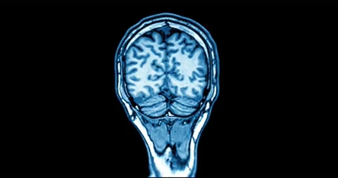 Medical scan showing human body part whi... | Stock Video | Pond5