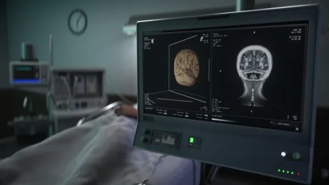 Medical scanner detects multiple deterio... | Stock Video | Pond5