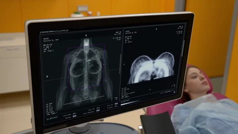 Medical test procedure scanning the woma... | Stock Video | Pond5