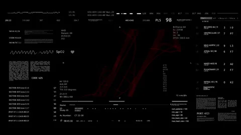 Medical UI HUD.CT scan. MRI x ray Scan. ... | Stock Video | Pond5
