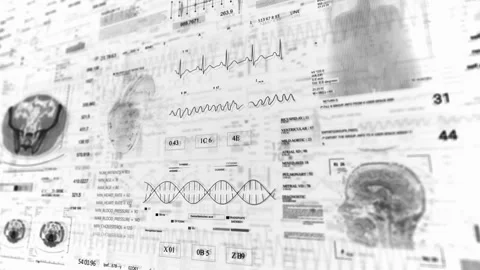 Medical UI monitoring MRI x ray Scan.Hea... | Stock Video | Pond5