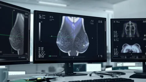 Medical x-ray analysis technology identi... | Stock Video | Pond5