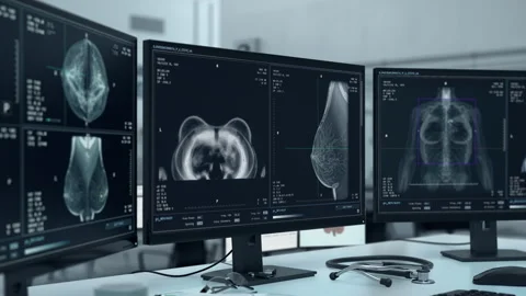 Medical x-ray equipment screening the or... | Stock Video | Pond5