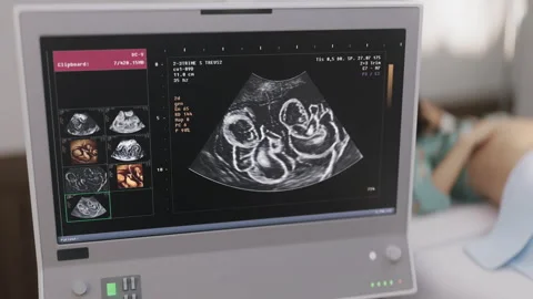Medical X-ray Examination Device For Sca... | Stock Video | Pond5