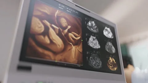 Medical X-ray Machine Scans Pregnant Wom... | Stock Video | Pond5