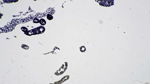 Meiosis of grasshopper in section under ... | Stock Video | Pond5