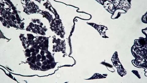 Meiosis of grasshopper in section under ... | Stock Video | Pond5