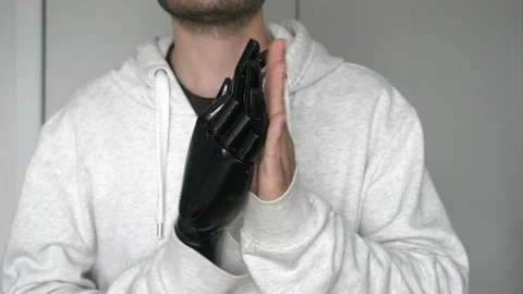 Men With an Artificial Prosthetic Hand C... | Stock Video | Pond5
