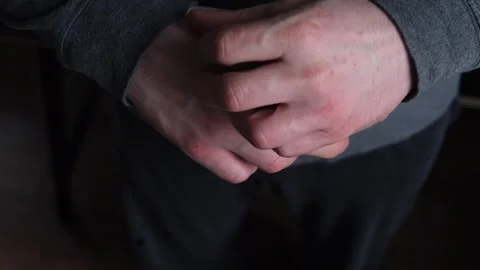 Men's hands scratch one another, a disea... | Stock Video | Pond5