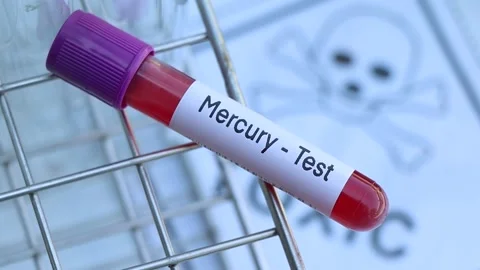 Mercury test to look for abnormalities f... | Stock Video | Pond5