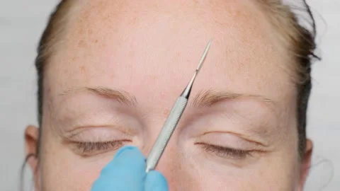 Chip Implant Stock Video Footage | Royalty Free Chip Implant Videos | Pond5