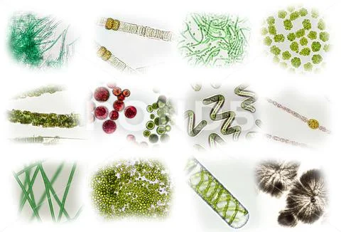 Cyanobacteria Microscopic 640+ Cyanobacteria Microscope Stock Photos,