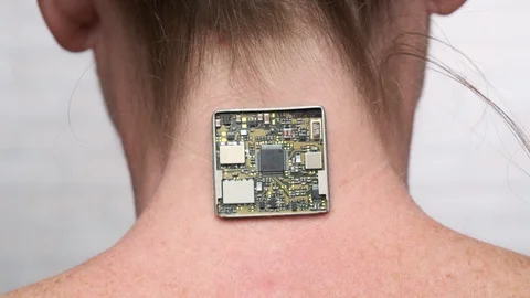 Chip Implant Stock Video Footage | Royalty Free Chip Implant Videos | Pond5