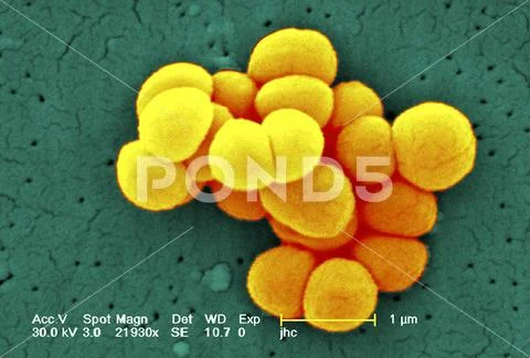 Photograph: Micrococcus luteus Micrococcus luteus, scanning electron ...